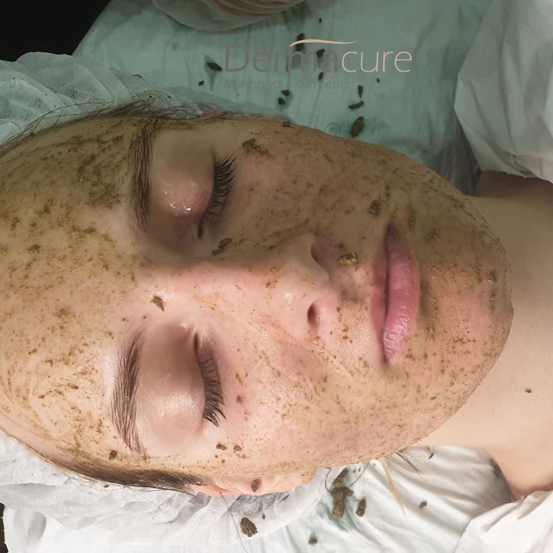 Dermacure London : The most exclusive Skin,Laser & Microblading Clinic