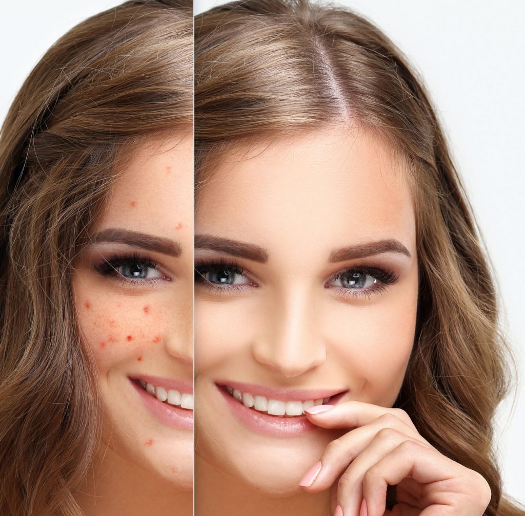 Dermacure London : The most exclusive Skin,Laser & Microblading Clinic