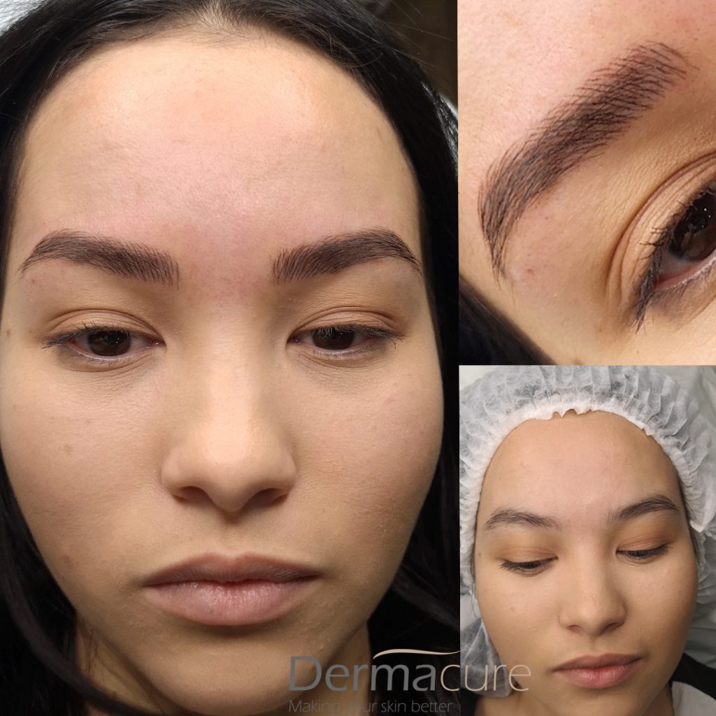 Microblading, Microblading Eyebrows, London - Dermacure
