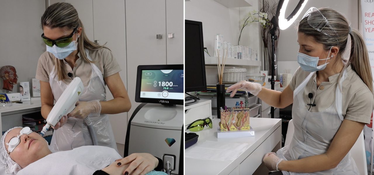 CleaLift, Laser Lift Treatment For Face, London - Dermacure